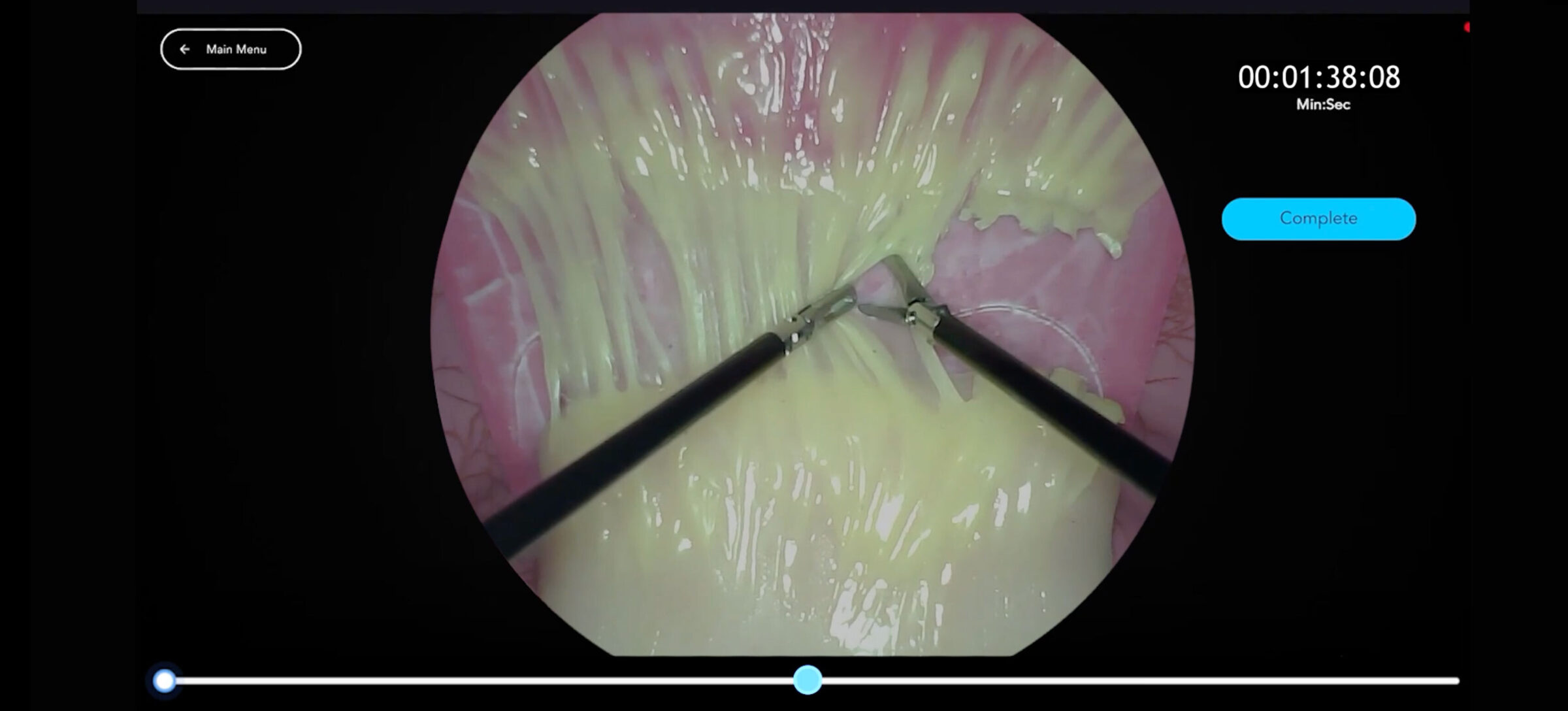 Inovus Medical | LapAR