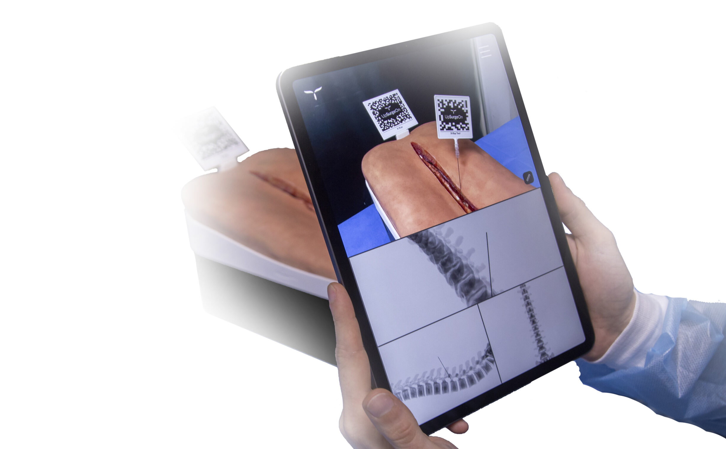 Inovus Medical | UpSurgeOn Neurosurgery and Spine