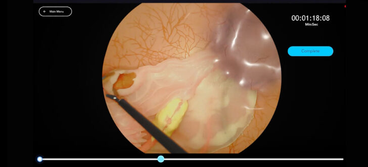 Inovus Medical | LapAR